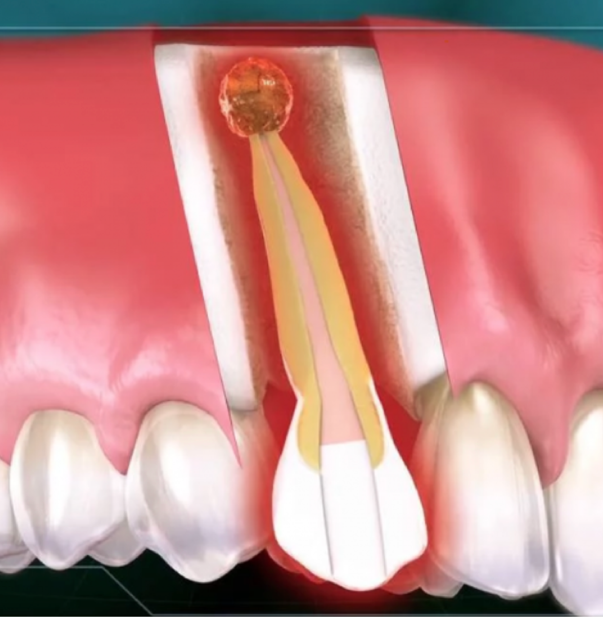 Our Services | Old Town Endodontics | Columbus GA Endodontist